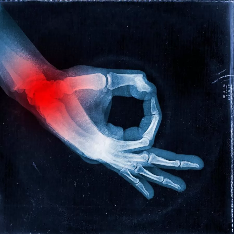 Event ITCHY - 10/12/2020 - Hannover - MusikZentrum - Germany